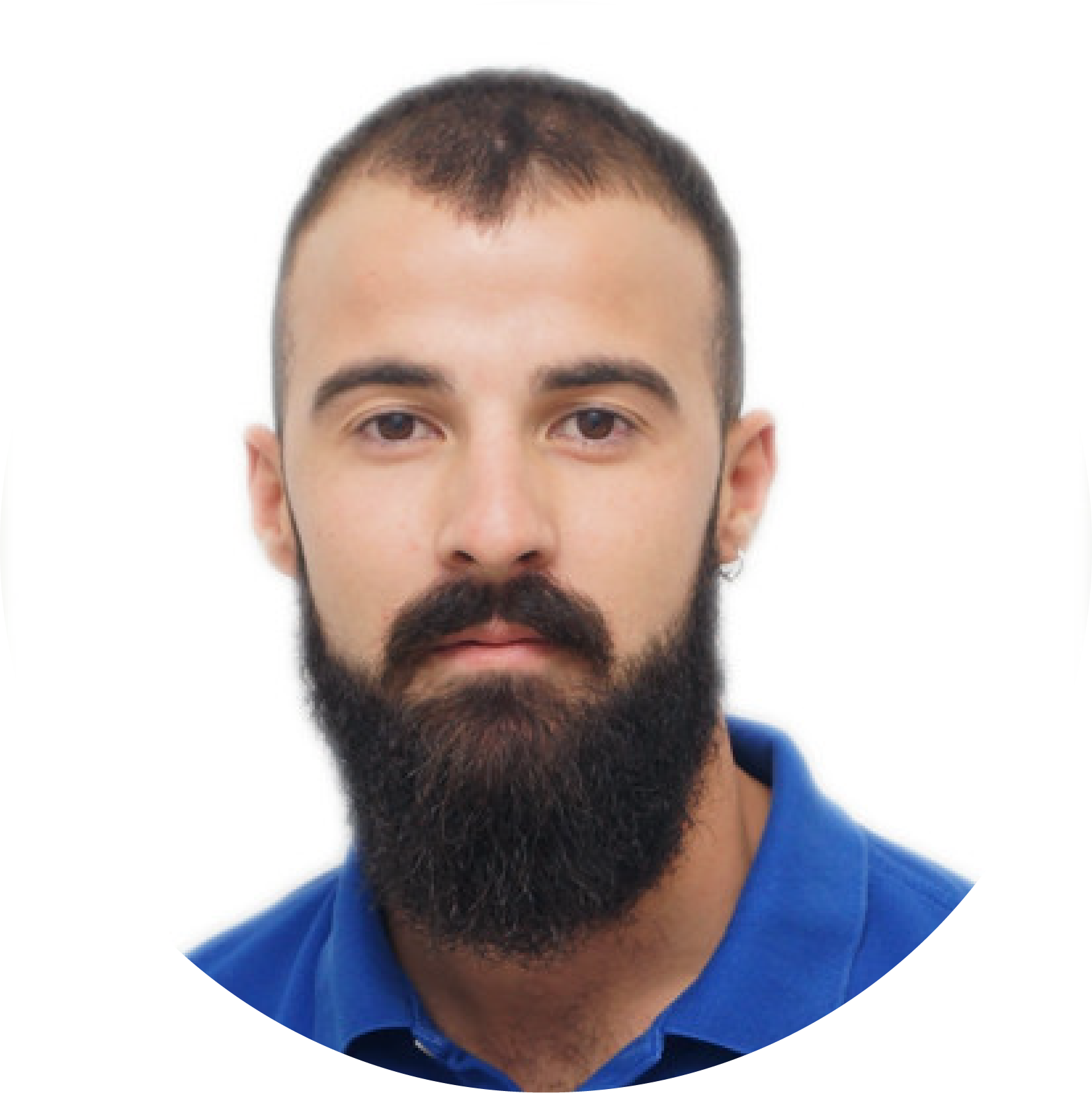 BLOG - Getting to the root of an alopecia areata EHDEN study-a-thon – ehden.eu